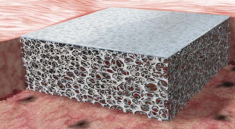 BTM - PMI – The Wound Healing Company